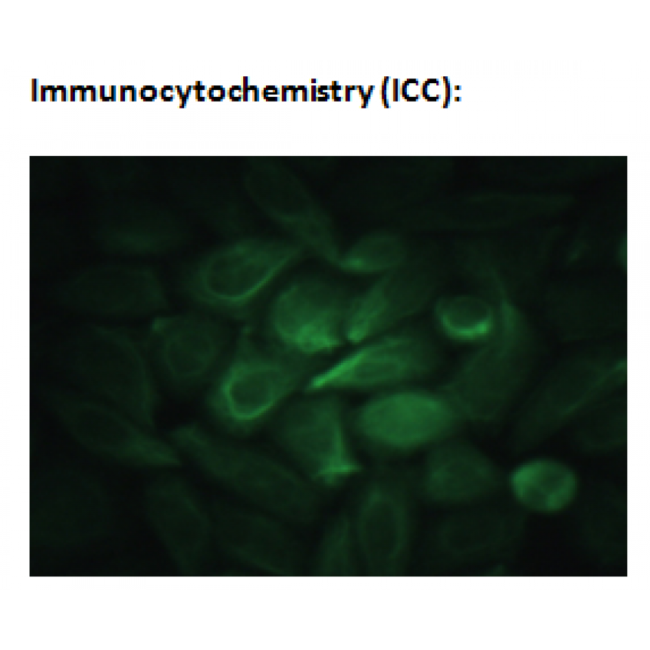mAb anti-Human EGF, S-146, Detector